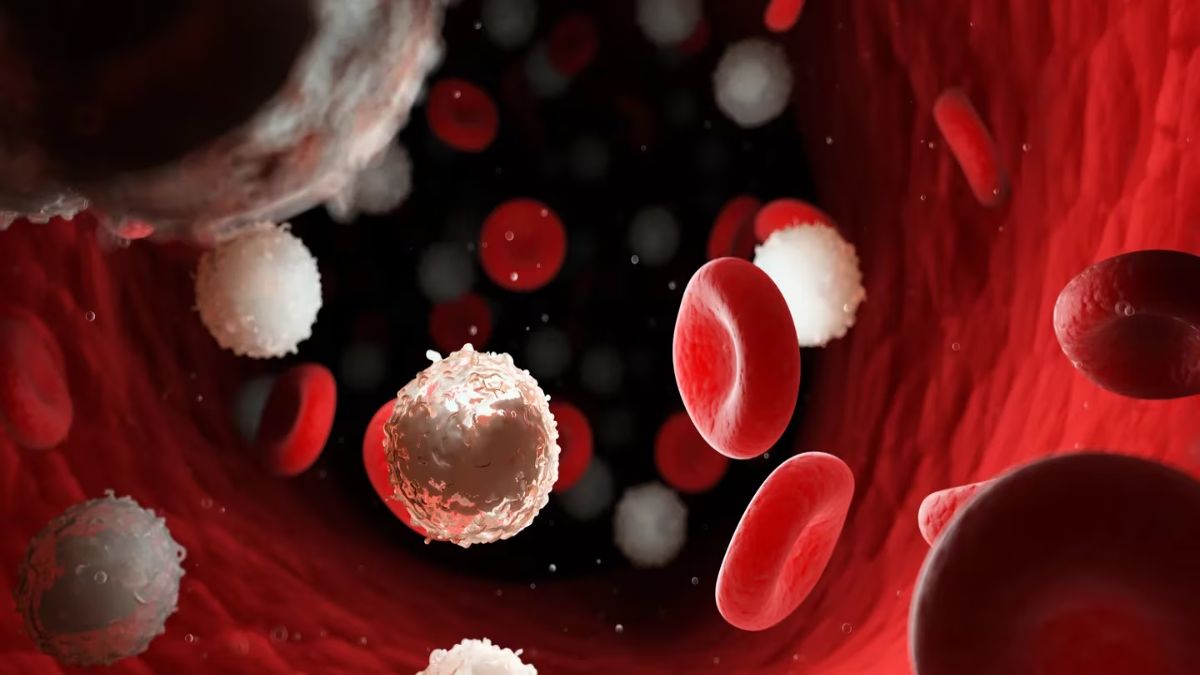 Qué es la leucemia y por qué es vital un diagnóstico a tiempo