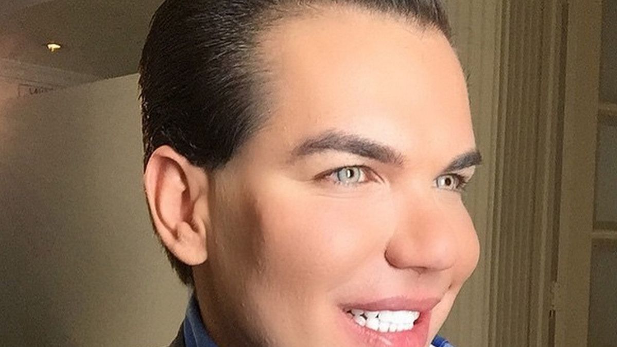 Gasta más 260 mil dólares para ser el Ken humano