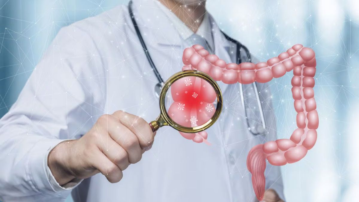 Intestino irritable: las 3 variantes existentes y sus síntomas
