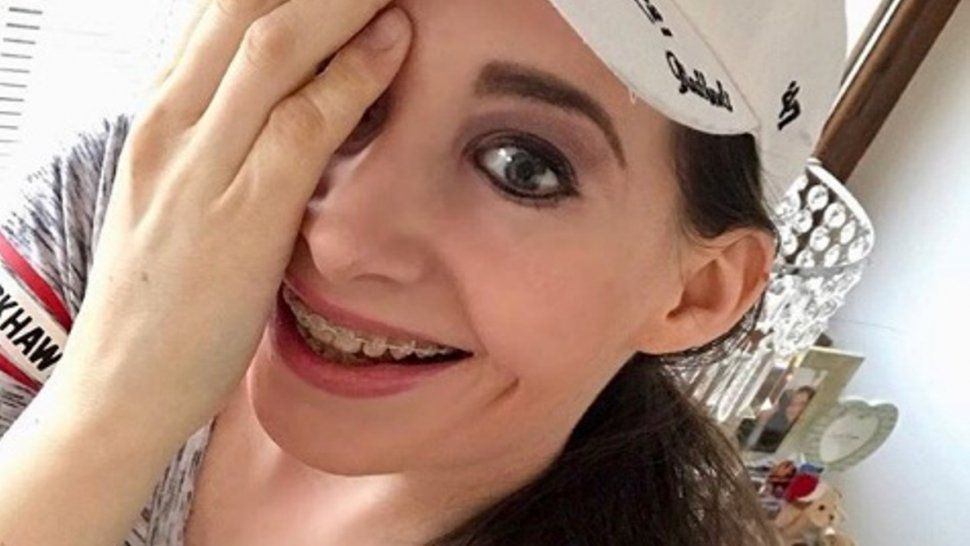 Volver A Nacer Nació Sin La Mitad Del Rostro Pero Mirá Cómo Quedó