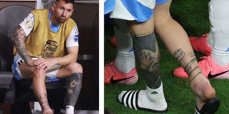 Lionel Messi fue a ver al Inter Miami y mostró como sigue su tobillo