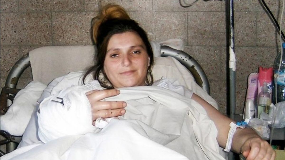 Le reimplantaron una mano amputada a una embarazada