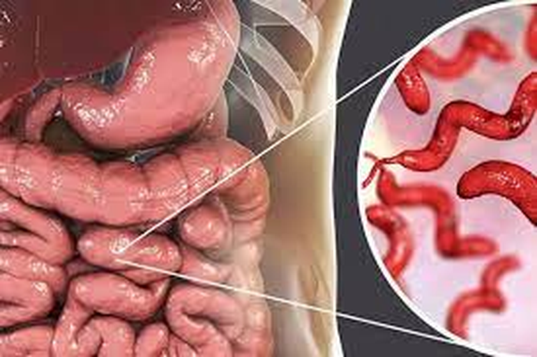 Argentina: más del 60% de los niños tienen parásitos intestinales